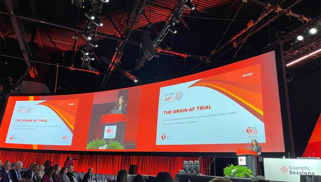 BRAIN AF: 리바록사반, 젊은 심방세동 환자에서 인지기능 저하·뇌졸중·TIA 예방 효과 없어 – NEWSROOM